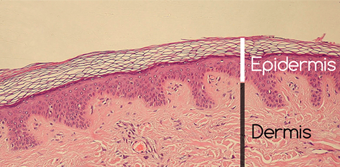 Aprendamos un poco mas: ¡Dermatología!
